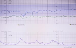 TM Flow Test Results Interpretation: Complete Guide